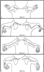 Farmacovigilancia HOY