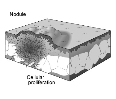 Raising Addie: November 2009