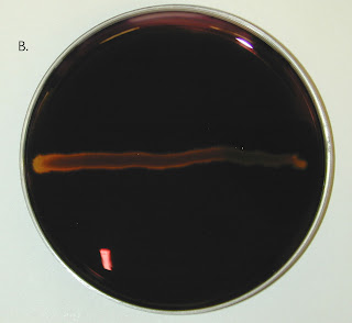 BIOCHEMICAL TESTS: STARCH HYDROLYSIS
