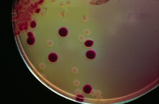 Biochemical Tests: MacConkey Agar