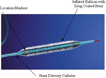 The IN VIVO Blog: Big Tent for Stent Trial Is All About Predictability ...