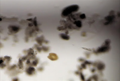 Encyclopedian Dictionary ( Akashiwo Sanguinea ): Akashiwo sanguinea ...