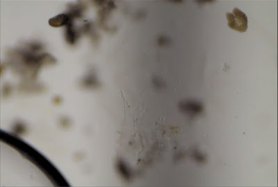 Encyclopedian Dictionary ( Akashiwo Sanguinea ): Akashiwo sanguinea ...