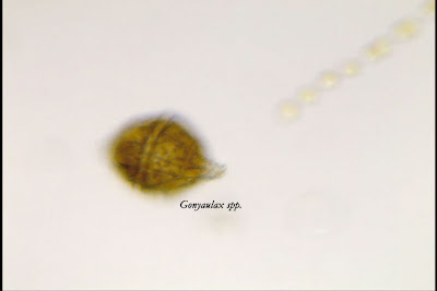 Encyclopedian Dictionary ( Gonyaulax ): Gonyaulax (Dinoflagellate) #006 ...