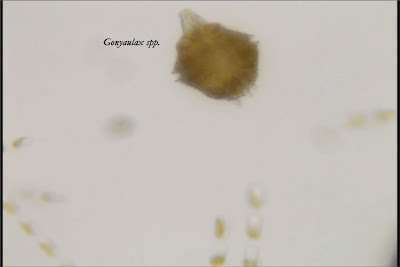 Encyclopedian Dictionary ( Gonyaulax ): Gonyaulax spp.