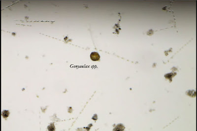 Encyclopedian Dictionary ( Gonyaulax ): Gonyaulax (Dinoflagellate) #006 ...