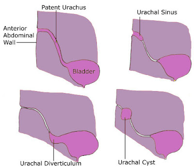 co není v hlavě...