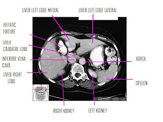 CT2009: LABELED CT ABDOMEN