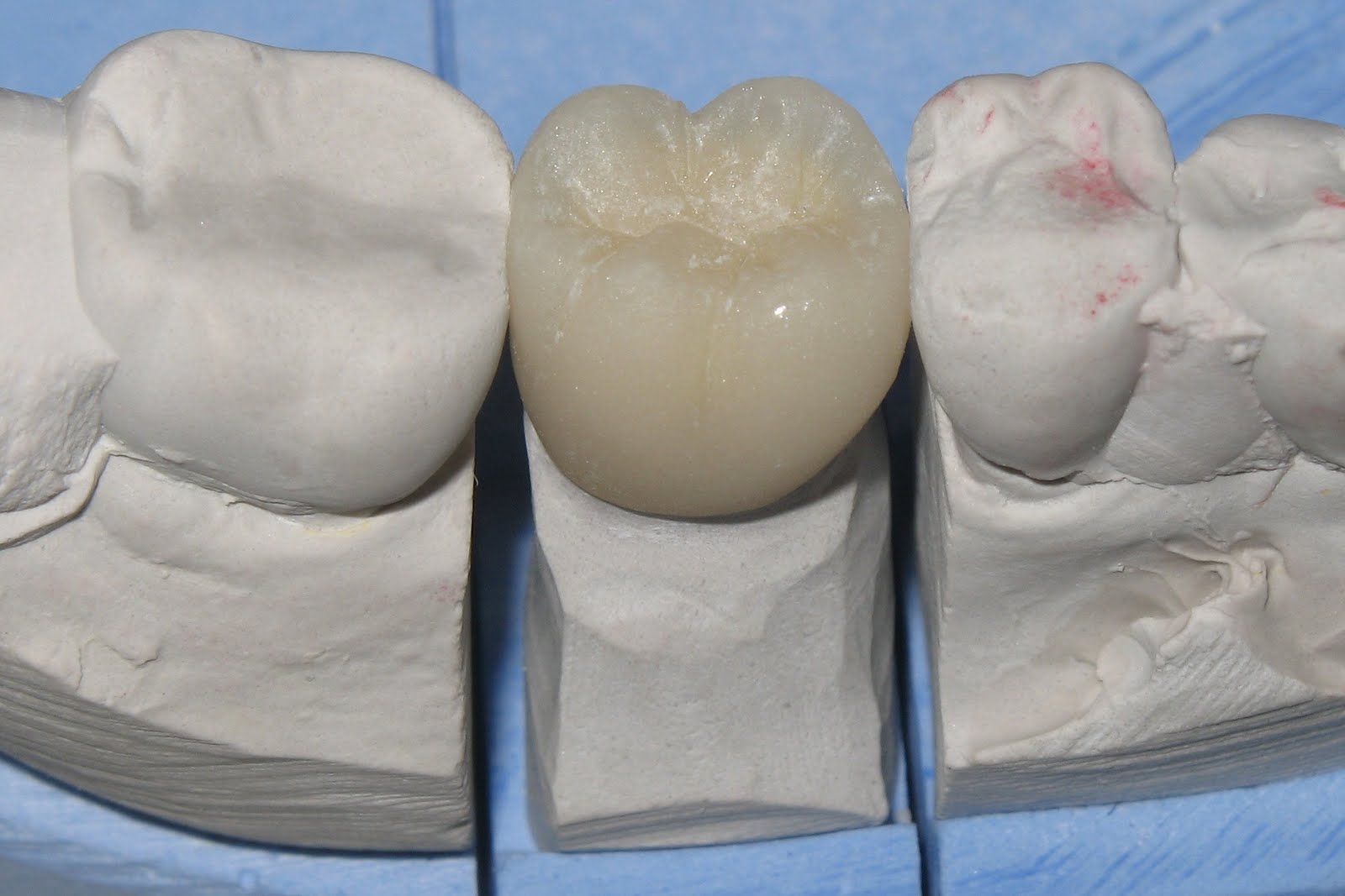 Authorized 3M Lava Milling Center