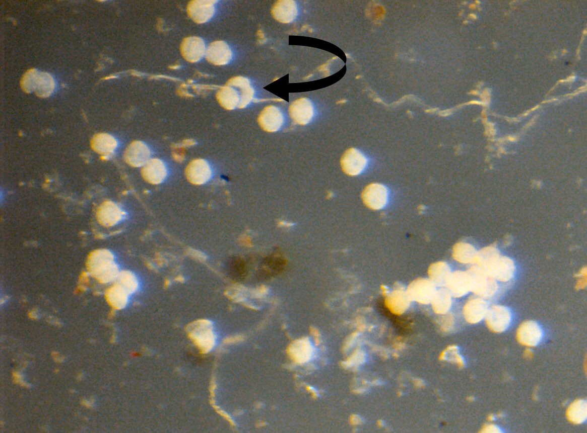 The Dish on Fish: Mussel Mania Part 3 - Glochidia