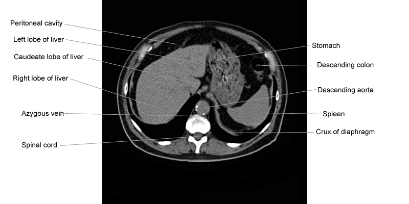 radiografer puja prandiska: MENGENALI PESAWAT CT Scan Multislice