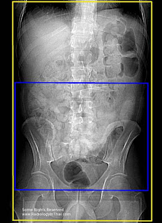 RiT radiology: June 2008