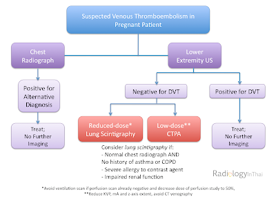 RiT radiology: Suspected Pulmonary Embolism in Pregnant Patient (2)