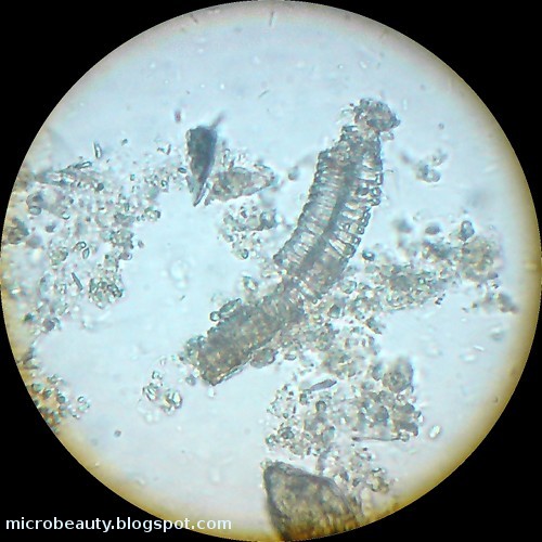 The Wonderful Microworld: Microorganisms in water.