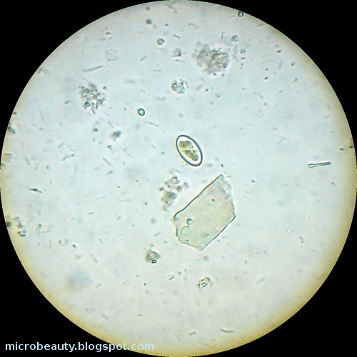 The Wonderful Microworld: Microorganisms in water.