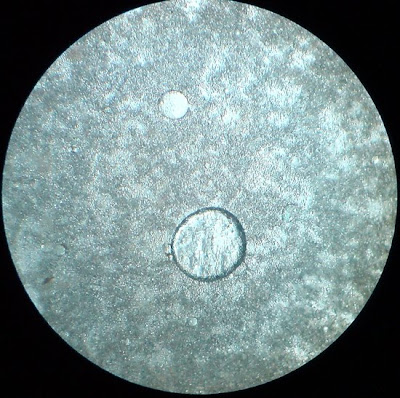 The Wonderful Microworld: Milk and the Curd (Fermented Milk) through ...