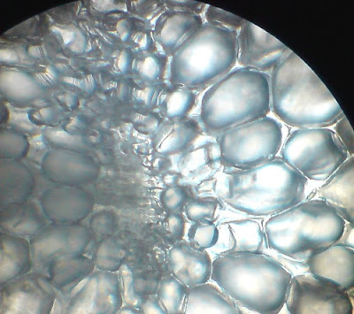 The Wonderful Microworld: Onion Cells - (Onion Bulb)