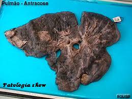 Patologia é Aqui: Pigmentação Exógena