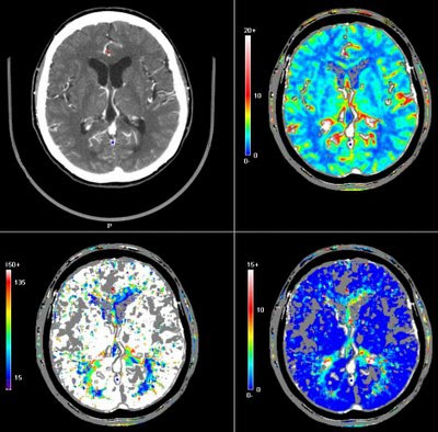 CT/USI: Perfusion Study