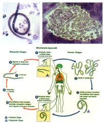 HKN KE-46 DI KOTA SERANG: SOSIALISASI PENYAKIT KAKI GAJAH ...