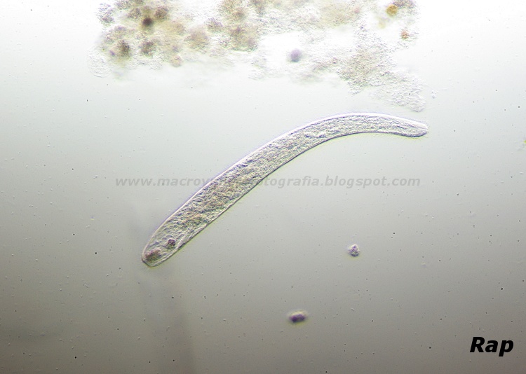 Macro y microfotografia: Microfotografía: Spirostomum