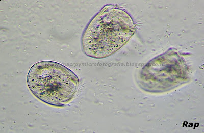 Macro y microfotografia: Microfotografía: Zoóspora de Vorticella