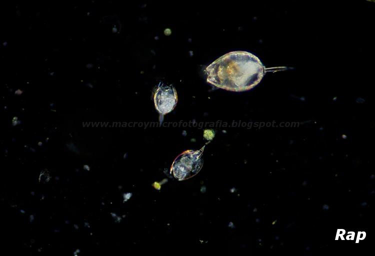 Macro y microfotografia: Microfotografía: Rotíferos 2