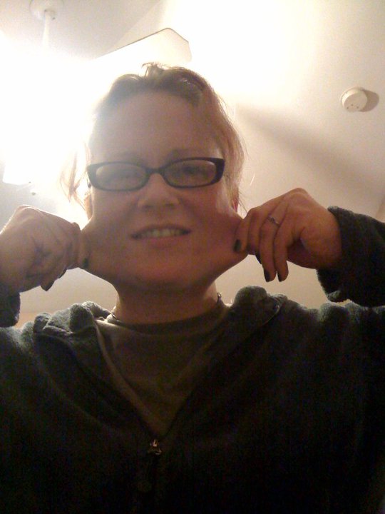 This Saga Called Life: What Does Ehlers Danlos Look Like? Here is how ...