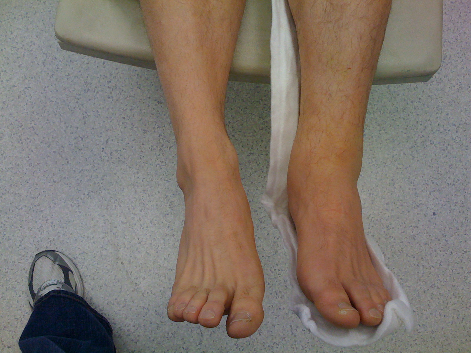 Roberts Family Broken Ankle