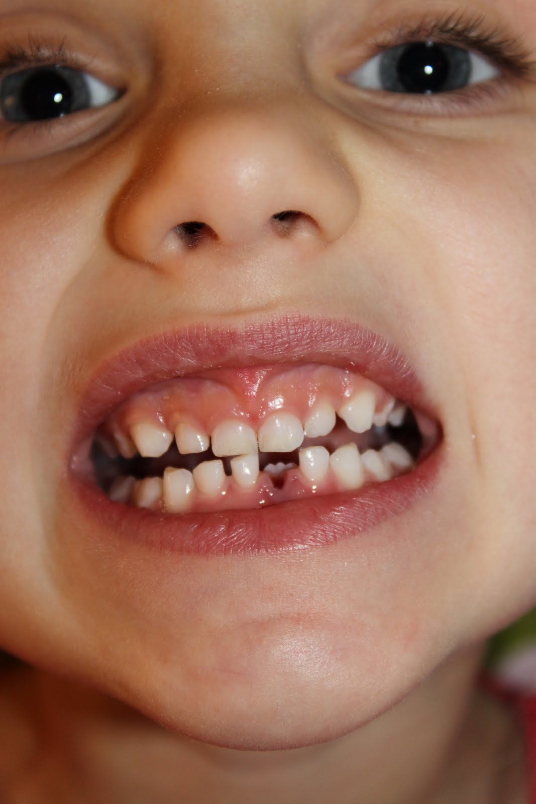 Mommy's Little Peanuts: Mary Beth lost her first baby tooth!!