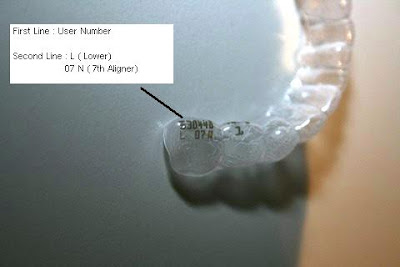 Invisalign Care: 1. How to take care of Invisalign Aligners