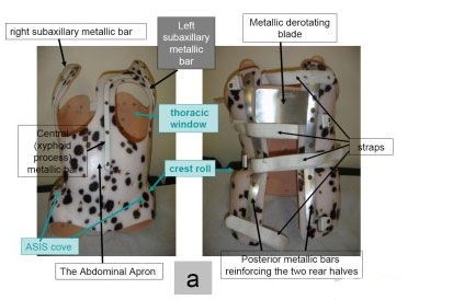 Brace technology: derotation brace