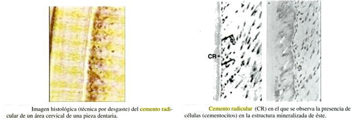 Periodoncia: CEMENTO RADICULAR