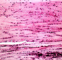 Kinds of Connective Tissue