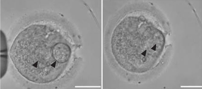 Trust Me, I'm a Scientist: Scientists Create Human Embryo with 3 Parents