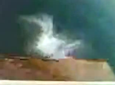 Robert Lindsay Returns: Face Split Diving Accident Video