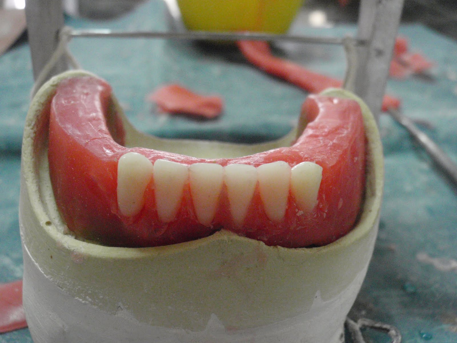 teeth setting | Wonderlust**Travelust