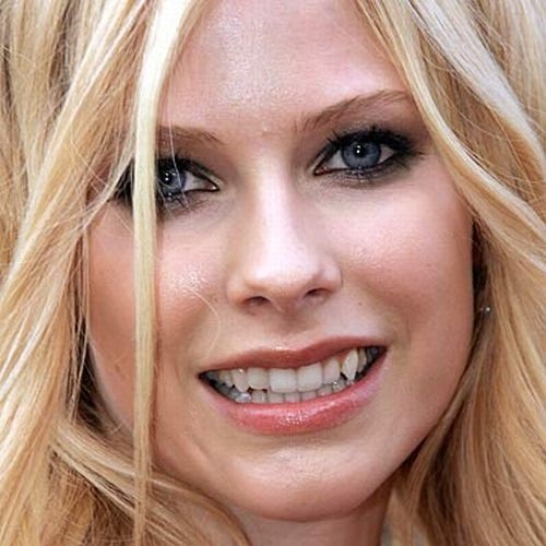 Crystal Lake Dental's Hot topics: Celebrity smiles that Need Help ...