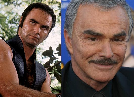 Blog do Terra: Famosos e suas plásticas