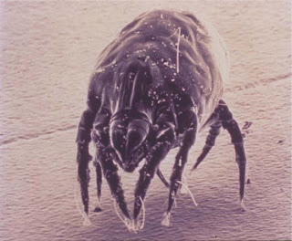 Dust mites pictures: Bed mites pictures, home bed mites pictures