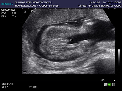 Fires From Ashes: Macho macho man ...