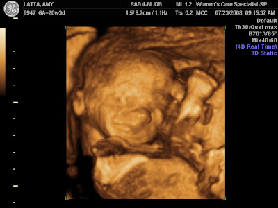 Amy Writes It All: Week 20 Ultrasound Pics