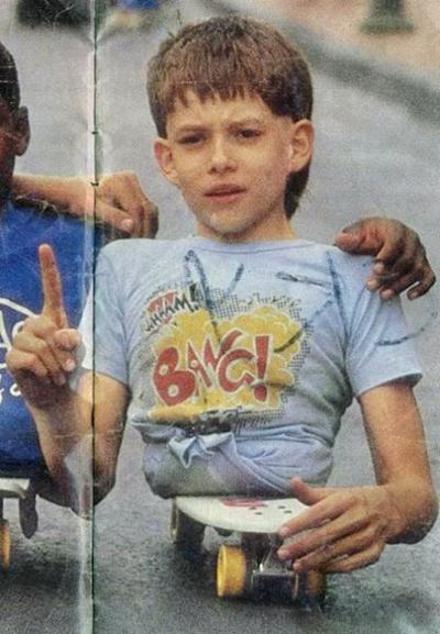 Amazing: The Man with Half a Body