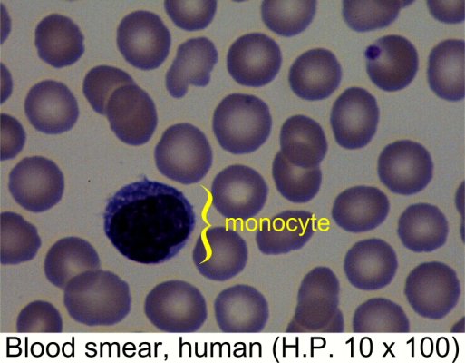 SHARE THE WONDERFUL BIOLOGY: BLOOD SMEAR SLIDES