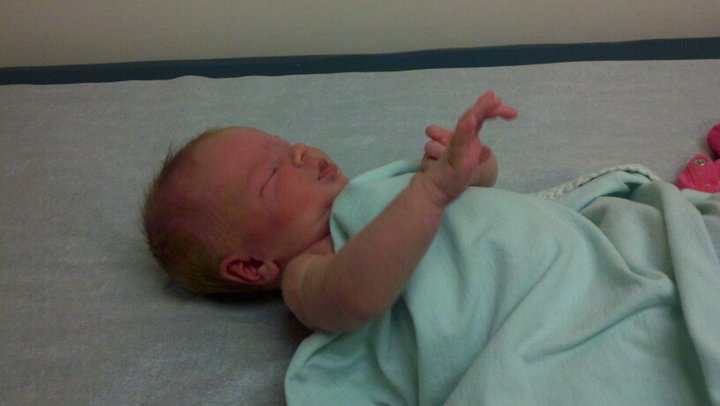 The Laufer Family Blog: Kaylyn's Umbilical Granuloma and other Concerns