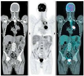 TEP Scanner | Magazine Médical