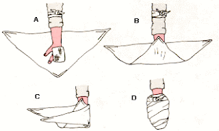 Socorrismo: VENDAJES