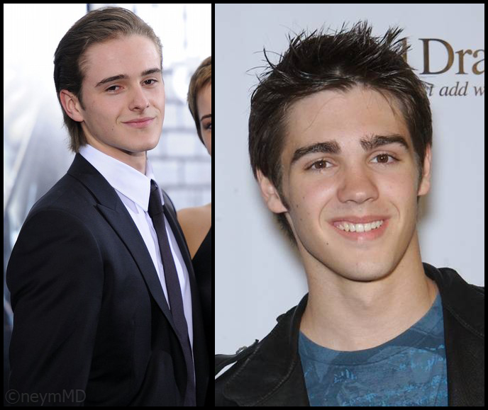 Toby And Alex Watson