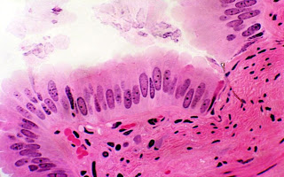 Punya Saya: Jaringan Epitel