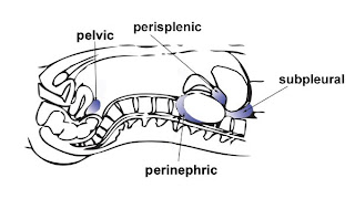 TRAUMA: TRAUMA ABDOMINAL PENETRANTE